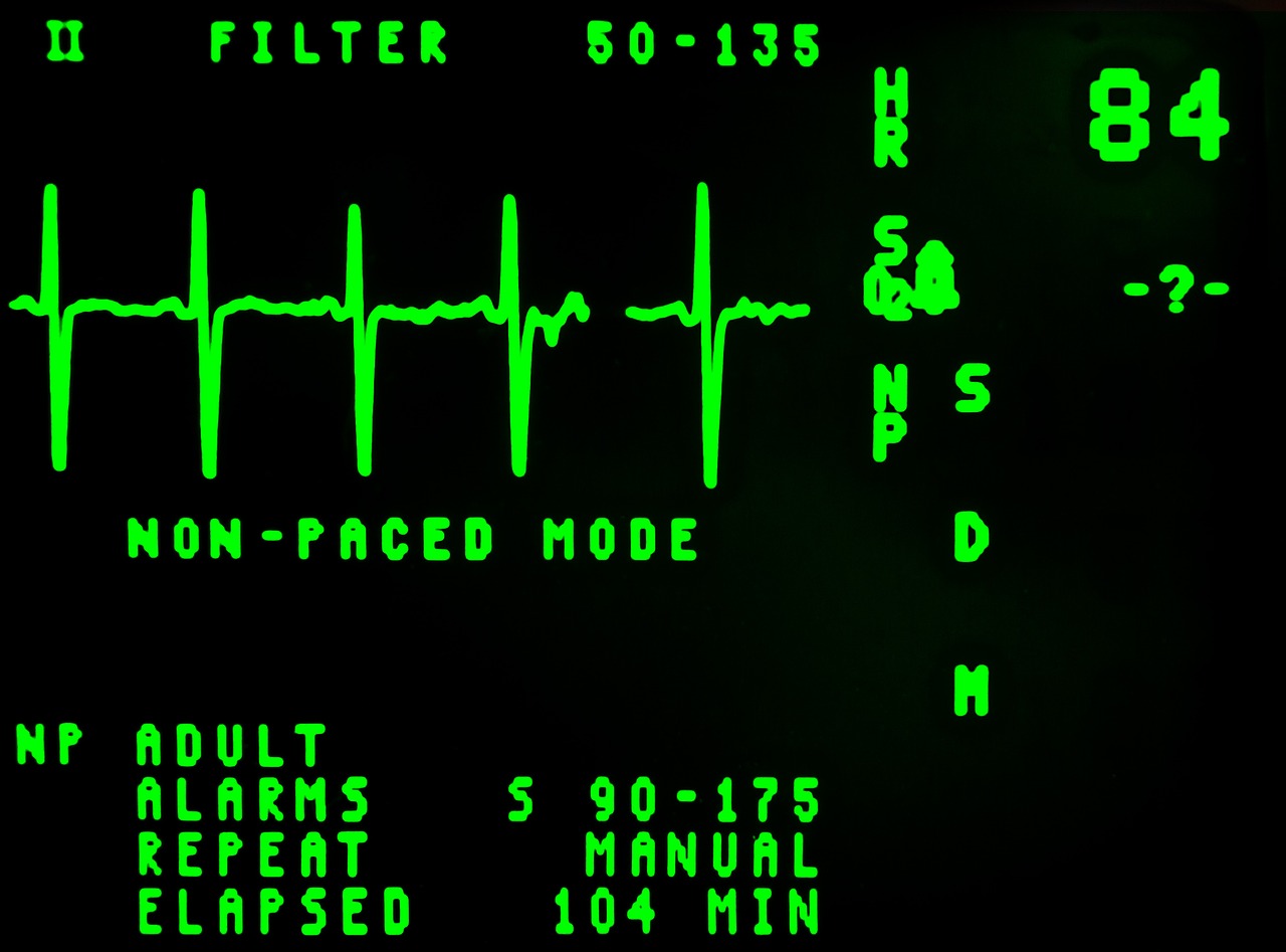 ECG Interpretation for Paramedics – The Medic Mentor