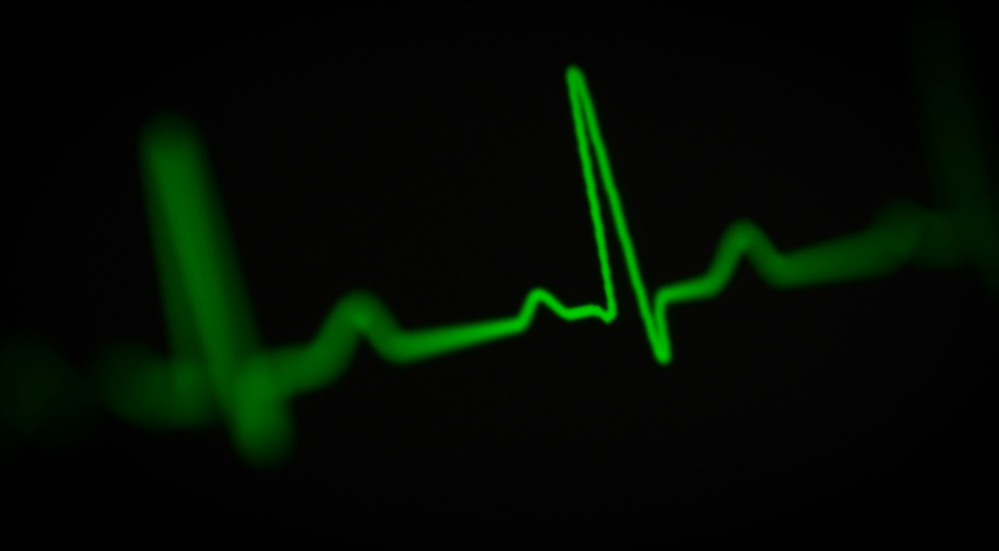 ECG Interpretation for Paramedics – The Medic Mentor