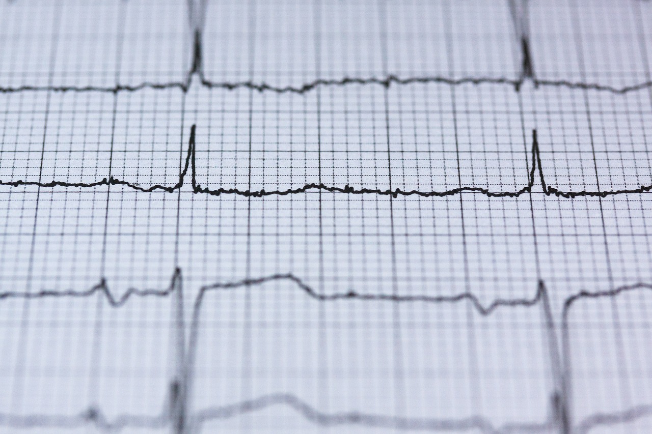 ECG Interpretation for Paramedics – The Medic Mentor